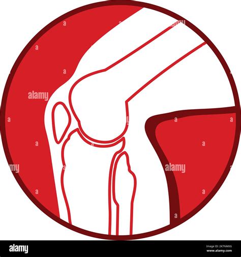 Knee Pain Round Icon Leg Joint Arthritis Sign Stock Vector Image And Art