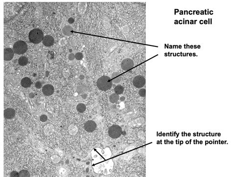 Lab Review Diagram Quizlet