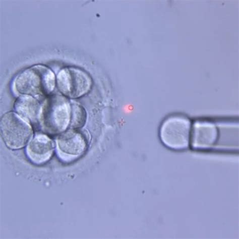 Pgt Testing Genetic Analysis Of Embryos Institut Marquès