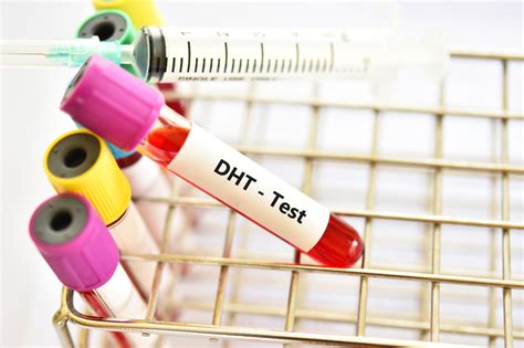 DHT Better Than T For Men Daily Medical Discoveries