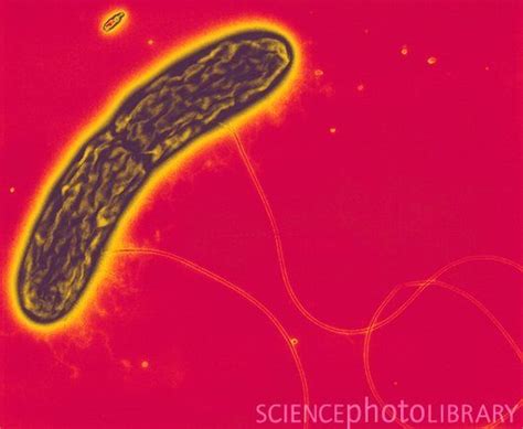 My Second Favorite Extremophile Microorganisms Popular Science