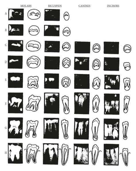 Developmental Stages Of Permanent Teeth According To Demirjians Method Download Scientific