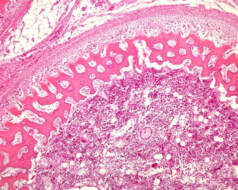Endochondral Ossification Of Immature Bone Light Micrograph Stock Image C048 3050 Science