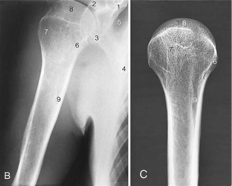 Di Shoulder Radiology 2 Diagram Quizlet