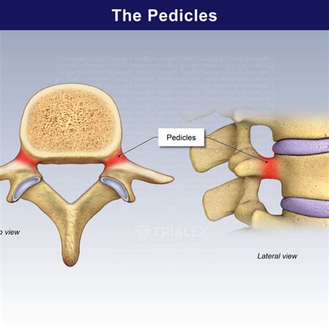 Medical Legal Exhibits Legal Animations And Trial Graphics Tria