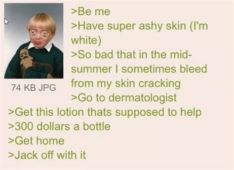 Anon Has Sensitive Skin Rgreentext