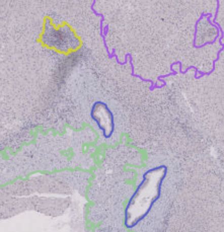 Issues With Exporting Masks From QuPath Image Analysis Image Sc Forum