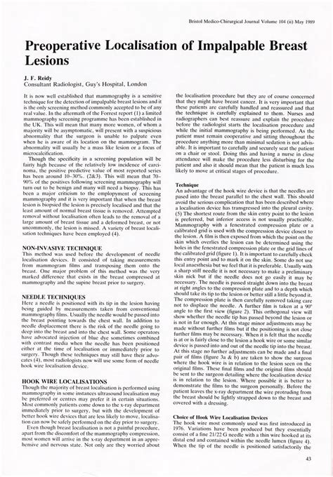 Pdf Preoperative Localisation Of Impalpable Breast Lesions