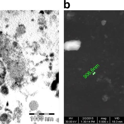 Electron Micrographs Of Mesenchymal Stem Cell Derived Vesicles Isolated