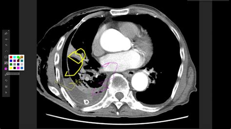 Interactive Annotation During Webex Lectures YouTube