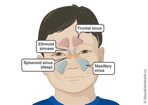 Maxillary And Ethmoid Sinus Disease