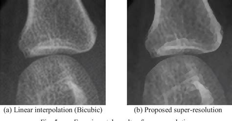 Figure 5 From Super Resolution For X Ray Images Semantic Scholar