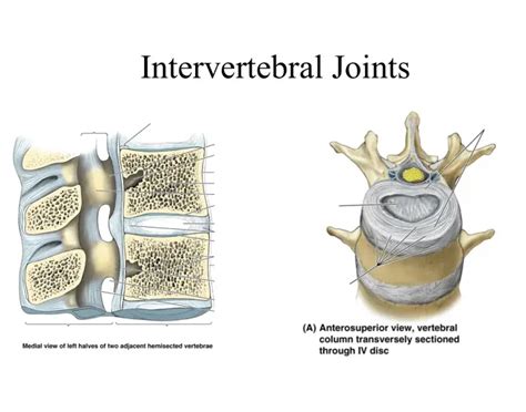 Intervertebral Joint Between Articular Process Physical Therapy Treatment And Exercise