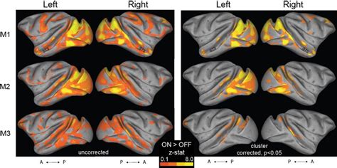 Visual Activation Onoff Contrast Maps In The Block Design