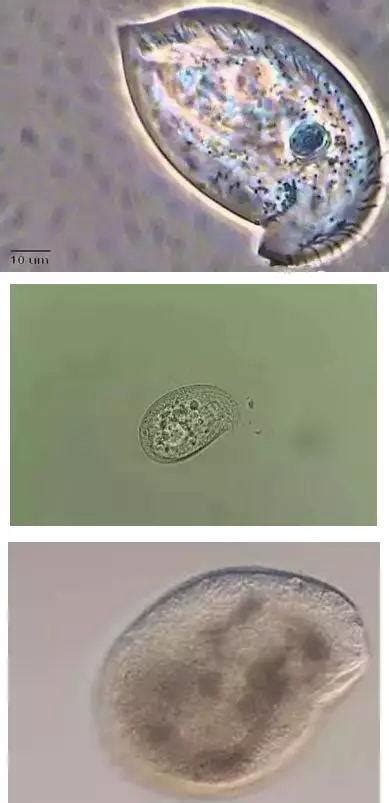 20种鱼类寄生虫图文病害收藏 中国鳗鱼网