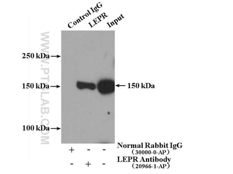 Lepr Rabbit Anti Human Mouse Polyclonal Proteintech 20 μl Unconjugated Lepr Rabbit Anti
