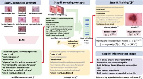 Concept Bottleneck With Visual Concept Filtering For Explainable