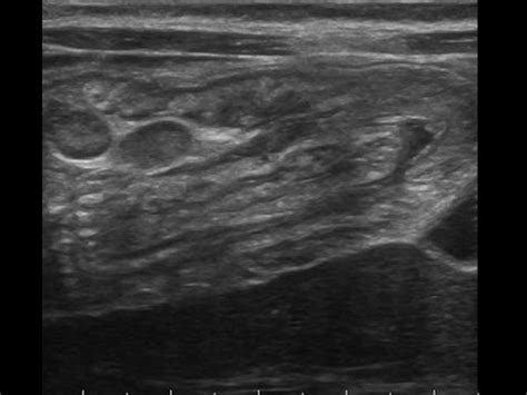 Pediatrics 91 Pediatric Abdomen And Retroperitoneum Case 912