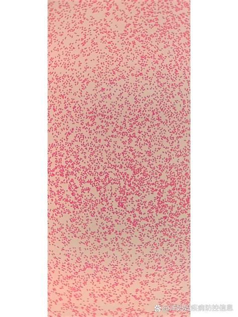 鲍曼不动杆菌（aba）