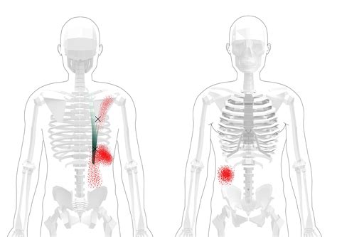 Upper Back Trigger Points Overview Tips And Exercises
