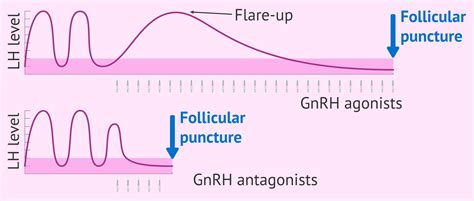 What Is A Short Ivf Protocol With Gnrh Antagonists