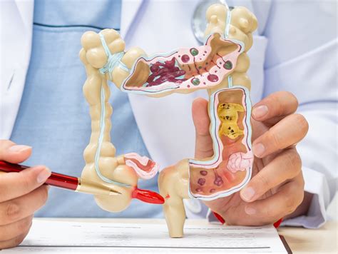 Appendicectomy Surgery In Singapore Dr Calvin Ong