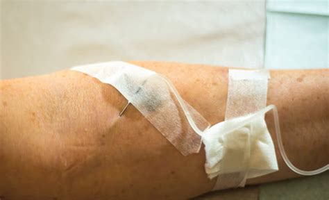 Clarify Coding For Drug Delivery Device You Be The Coder