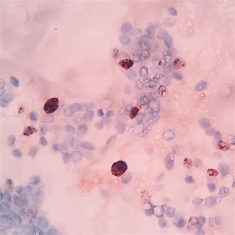 Ihc Synaptophysin On Cell Block Download Scientific Diagram