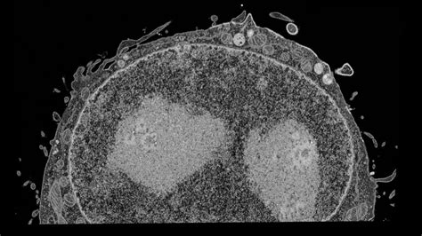[video] zeiss arivis on linkedin ai assisted 3d segmentation of fib