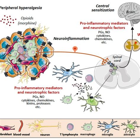 Tumor Microenvironment As A Scenario Of Neuroinflammation And Central