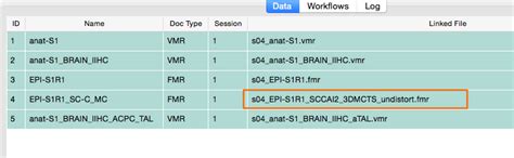 Including Epi Distortion Correction In Data Analysis Workflow