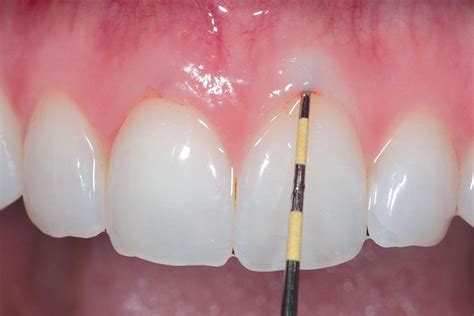 What Is A Perio Chart Maritza O Jenkins Dmd General Dentist