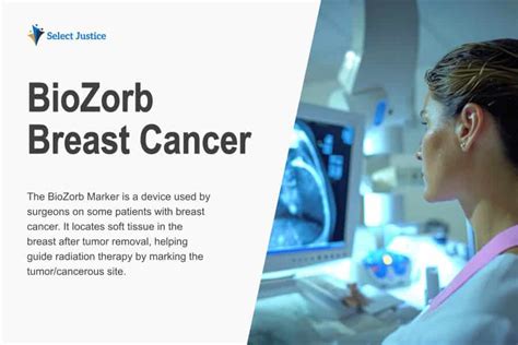 Biozorb Implant Lawsuit March 2025 Select Justice