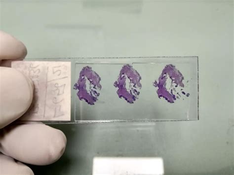 Premium Photo Stained Histology Slide Which Is Ready For Microscopic