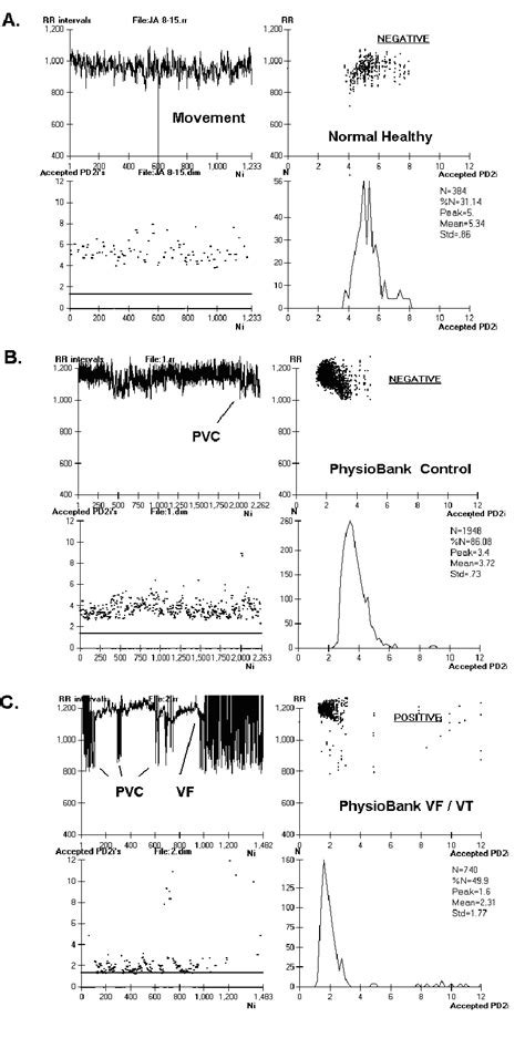 Relative Risk Rr Intervals And Associated Pd2is Determined From The Download Scientific