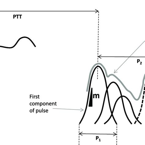 A −dschematic Of Pleth Modulation Components Due To Respiration
