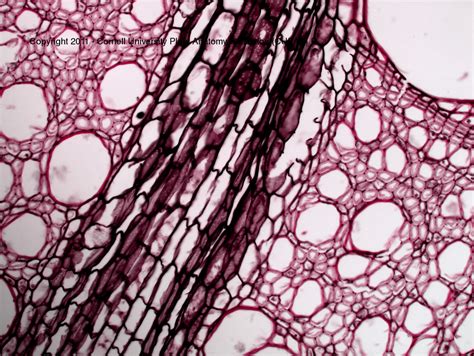 Tracheids Under Microscope