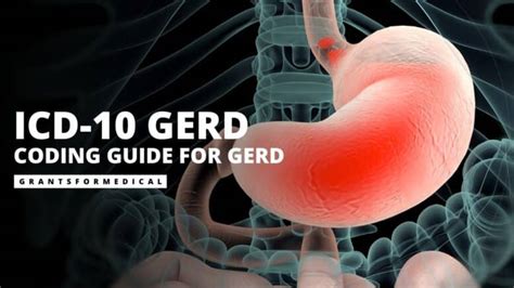 Icd 10 Gerd Coding Guide For Gerd Grants For Medical