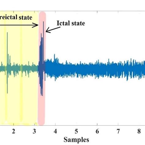 Signal Characteristics Between EEG And IEEG Signals Download Scientific Diagram