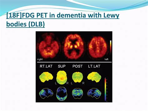 Functional Neuroimagingpptx Pptx