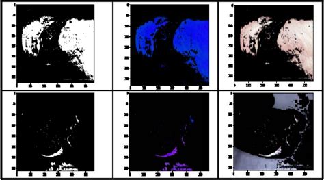Figure 1 From Diabetic Foot Ulcer Segmentation Using Color Space Models