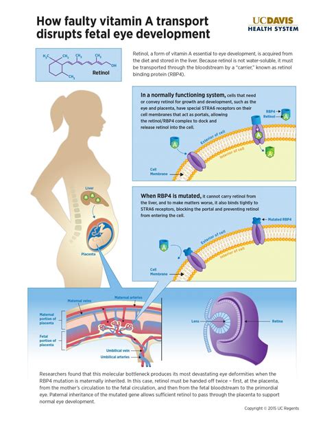ანატომია Anatomy პირველადიდახმარება 📌ასთმური შეტევა 🔴ბრონქული ასთმა სასუნთქი გზების