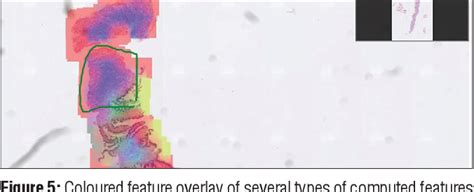 Figure 5 From Deep Learning Based Retrieval System For Gigapixel Histopathology Cases And The
