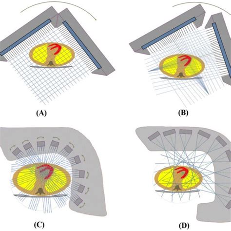 Illustration Of Different Cardiac Spect System Configurations A