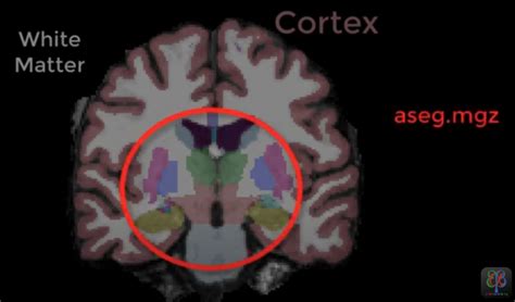 Freesurfer全过程梳理 Csdn博客