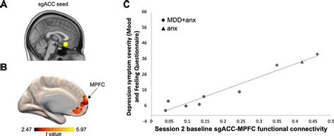 Higher Dmn Functional Connectivity Was Associated With More Severe
