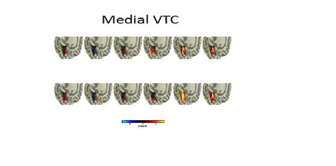 File Medial Vtc Scans Psych Image Systems Engineering