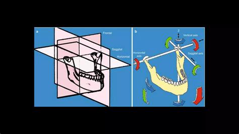 Hinge Axis Pptx Hinge Axis Pptx