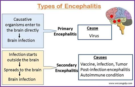 Encephalitis Causes Treatment Prevention We Care