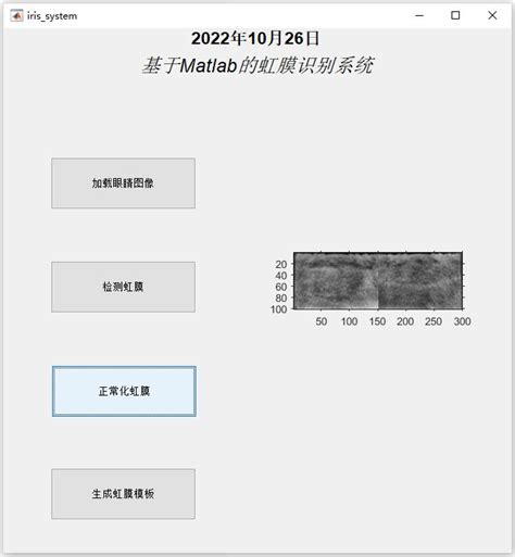 基于matlab的虹膜识别系统 gui界面 索炜达 猿创